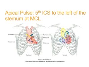 What is Apical Pulse: Definition and Process of Measurement